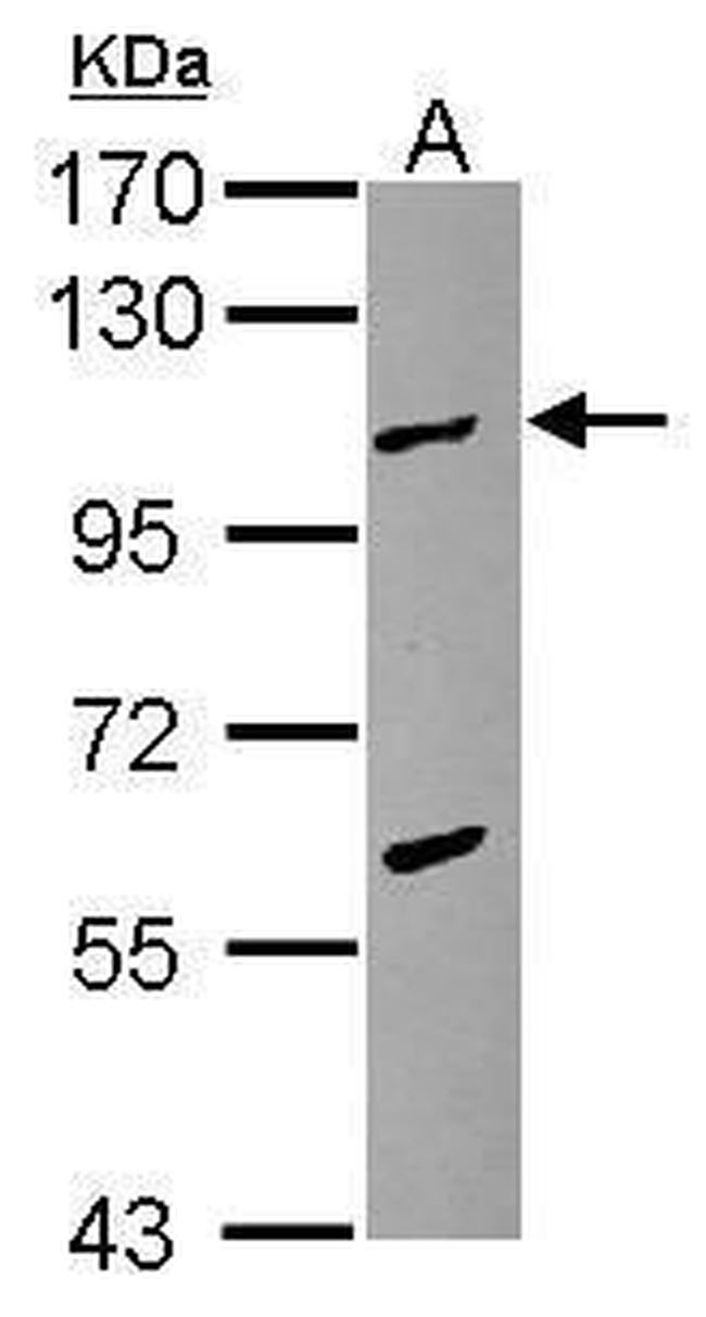 TPX2 Polyclonal Antibody (PA5-30455)
