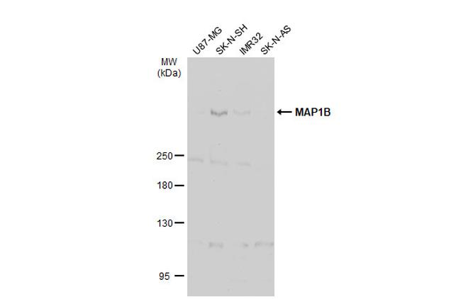 MAP1B Antibody (PA5-30584)
