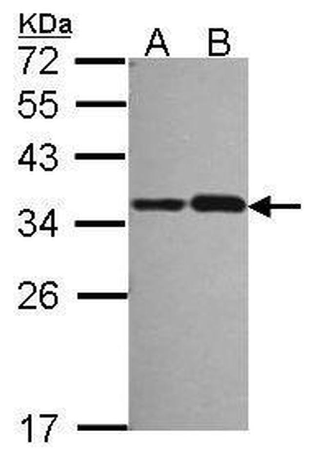 Western blot analysis - myepery