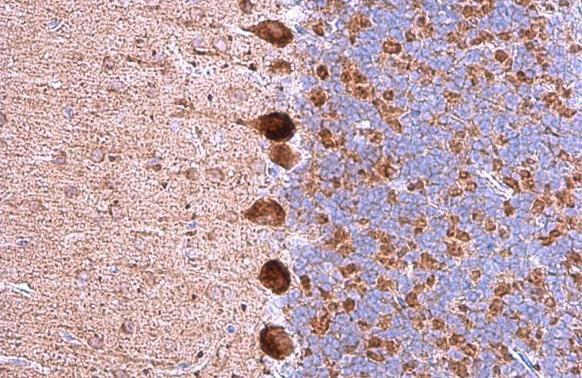 GABRA5 Polyclonal Antibody (PA5-31163)