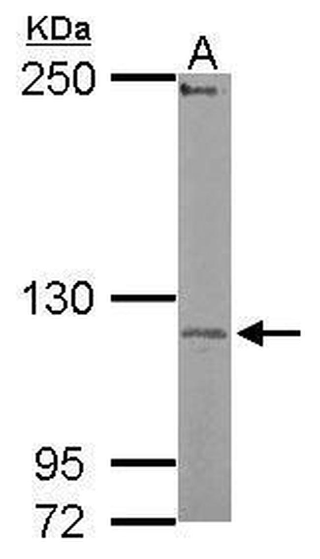 UBE3C Polyclonal Antibody (PA5-31350)