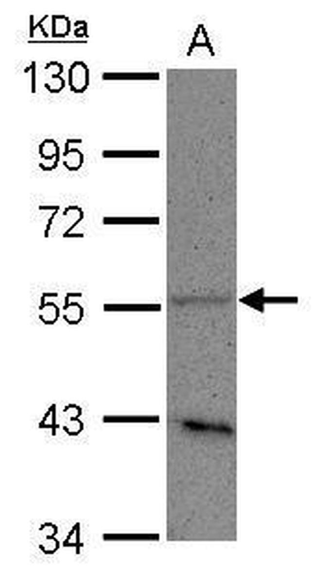 PLD3 Polyclonal Antibody (PA5-31959)