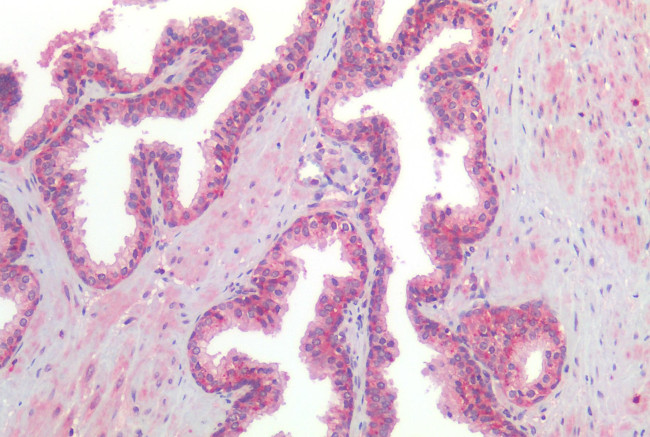 GPR160 Polyclonal Antibody (PA5-33650)