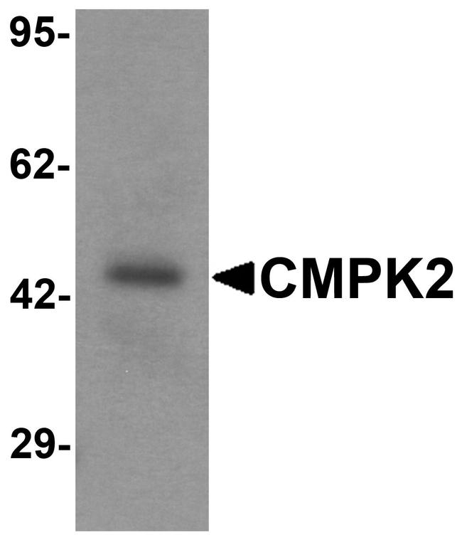 CMPK2 Antibody (PA5-34461)