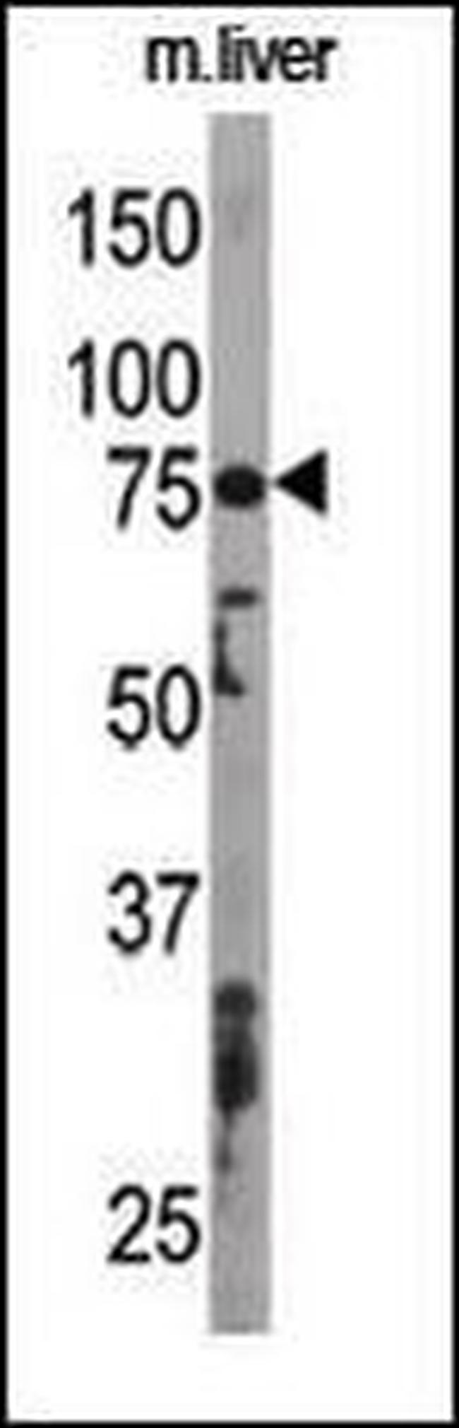 ATG7 Antibody (PA5-35203)