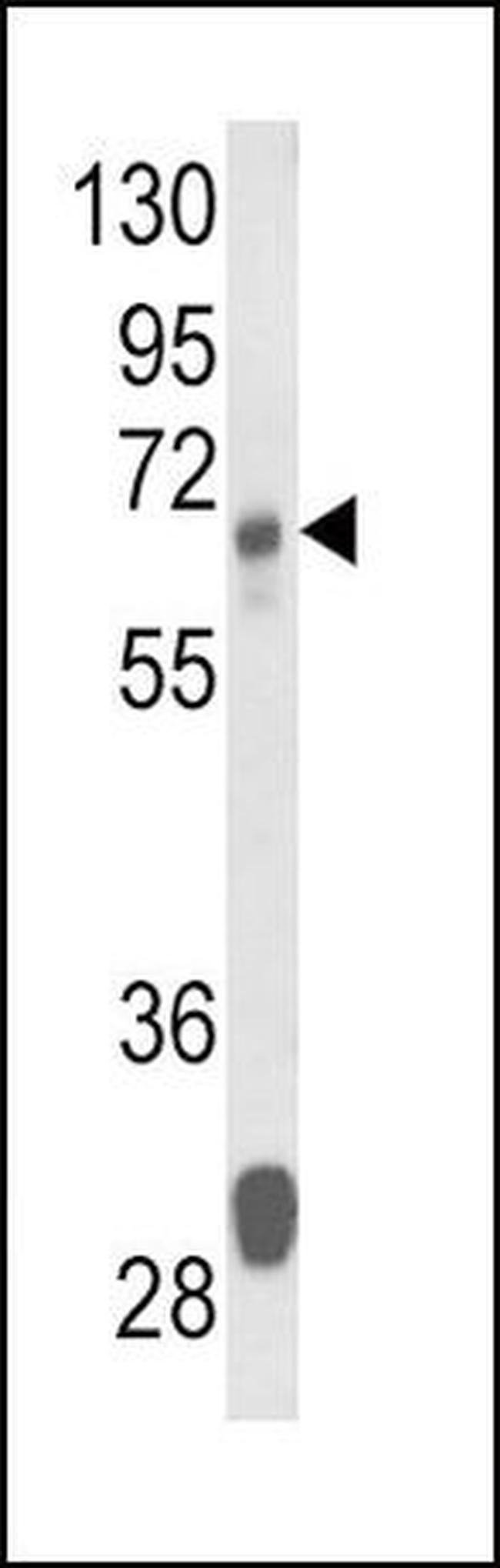 Glutaminase Antibody (PA5-35365)