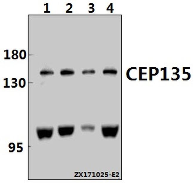 CEP135 Polyclonal Antibody (PA5-36440)