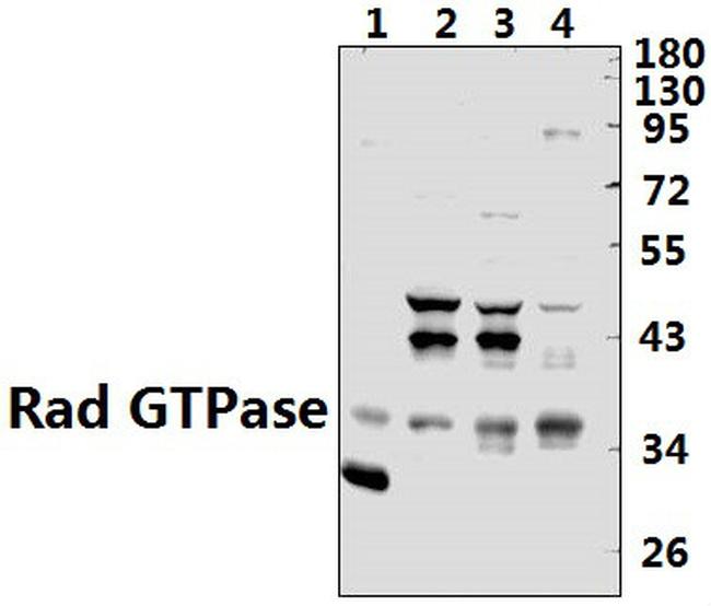 RRAD Polyclonal Antibody (PA5-36460)