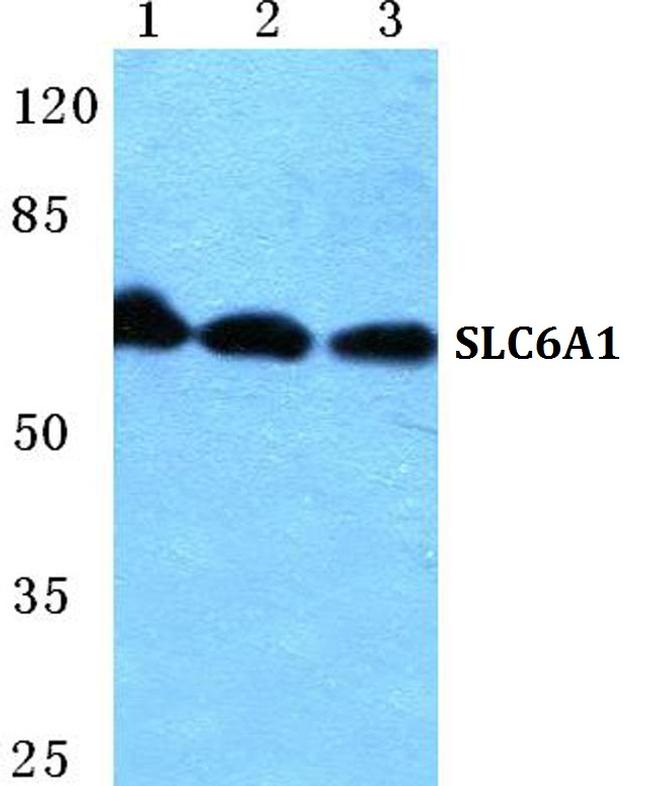 SLC6A1 Polyclonal Antibody (PA5-36956)