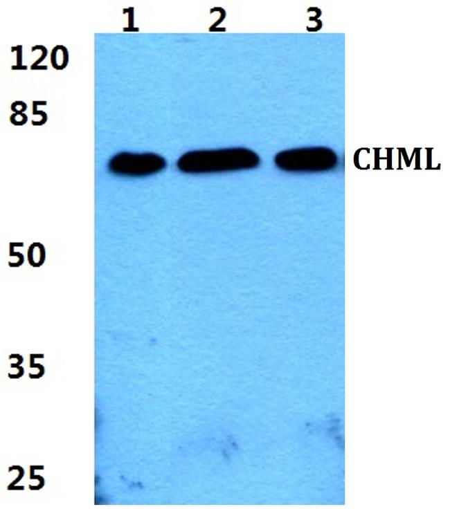 CHML Antibody (PA5-37038)