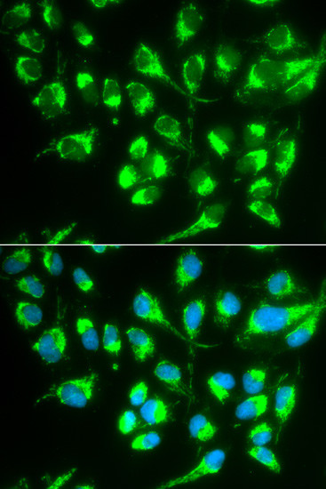 SLC22A5 Antibody (PA5-37389)