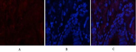 Phospho-CaMKII beta/gamma/delta (Thr287) Polyclonal Antibody (PA5-37833)