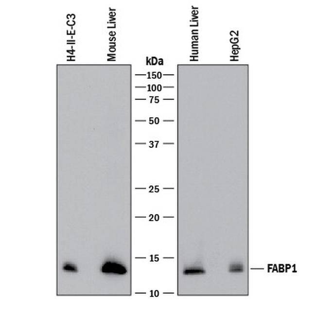 FABP1 Polyclonal Antibody (PA5-47159)