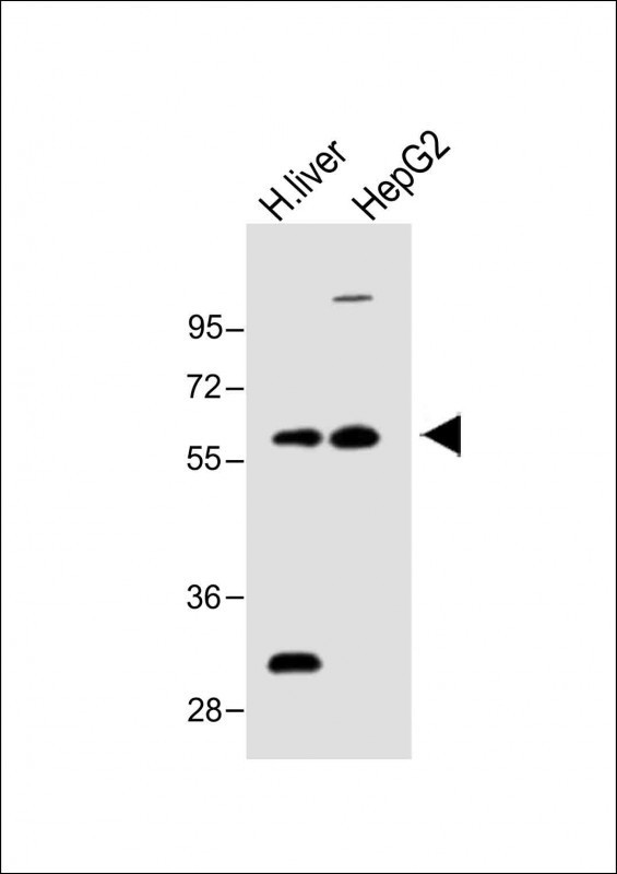 FADS2 Polyclonal Antibody (PA5-48353)