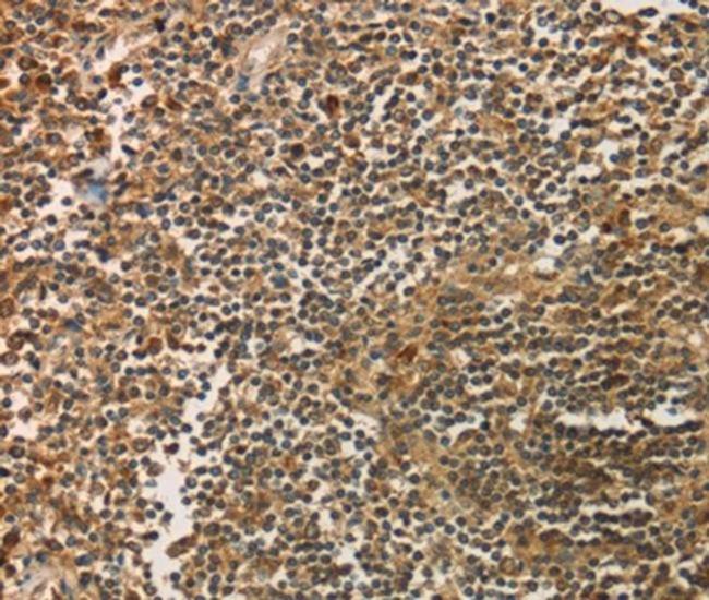 SIGLEC15 Antibody (PA5-50759)