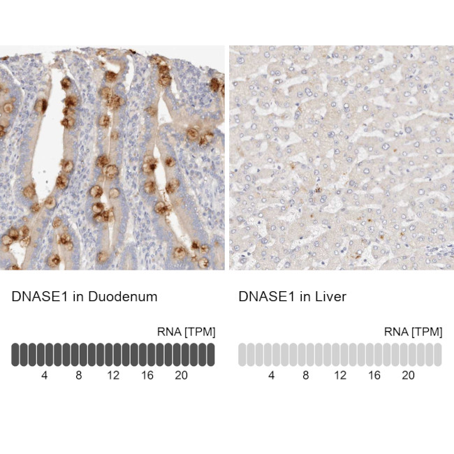 DNASE1 Polyclonal Antibody (PA5-52731)