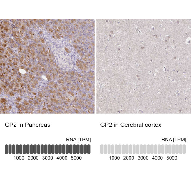 GP2 Polyclonal Antibody (PA5-53375)