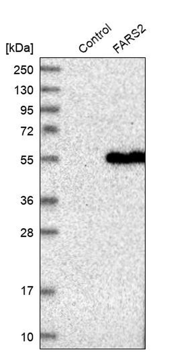 FARS2 Polyclonal Antibody (PA5-53738)