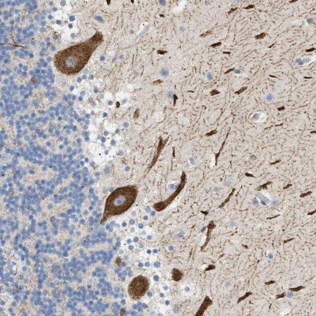 FARS2 Polyclonal Antibody (PA5-53738)