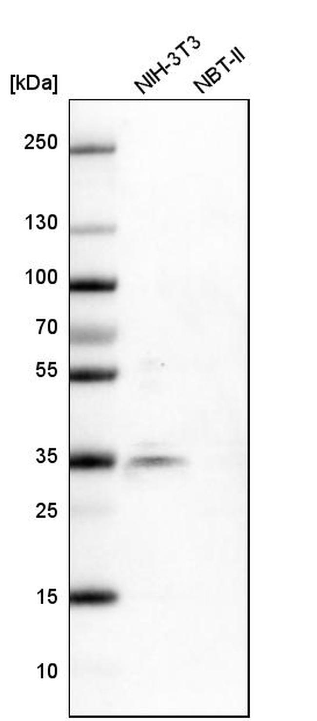 SRSF6 Polyclonal Antibody (PA5-56034)