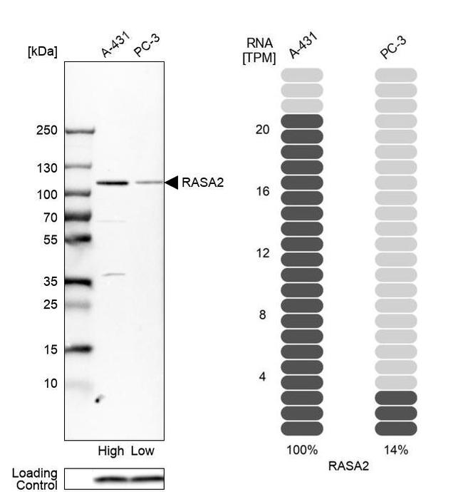 RASA2 Antibody (PA5-57247)