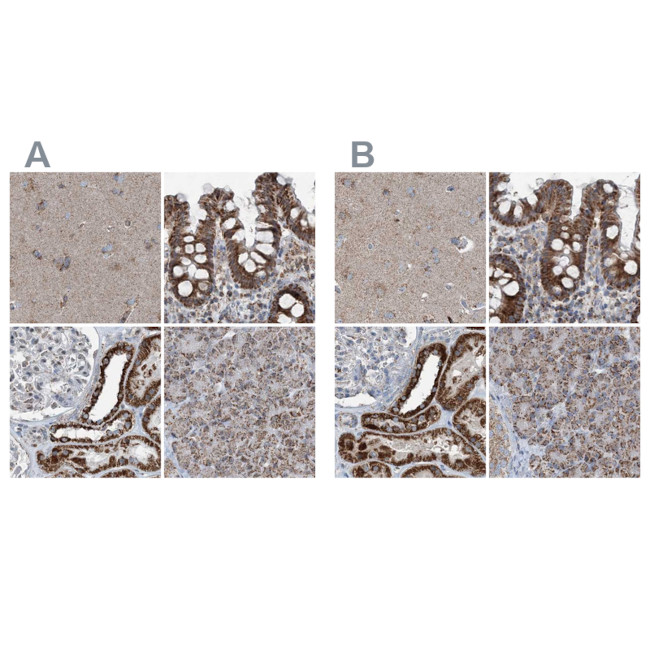 SUCLG1 Antibody (PA5-57767)