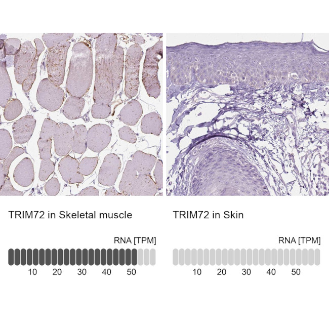 TRIM72 Polyclonal Antibody (PA5-63039)