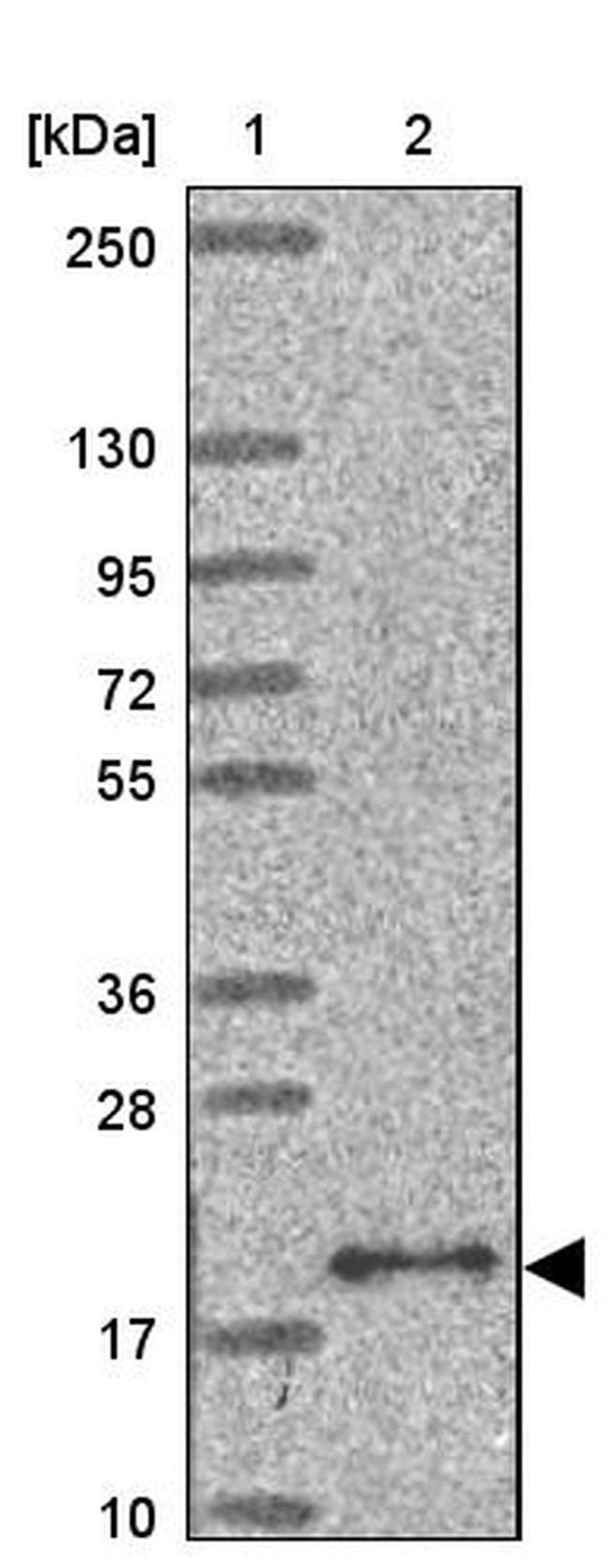 AP1S1 Antibody (PA5-63913)