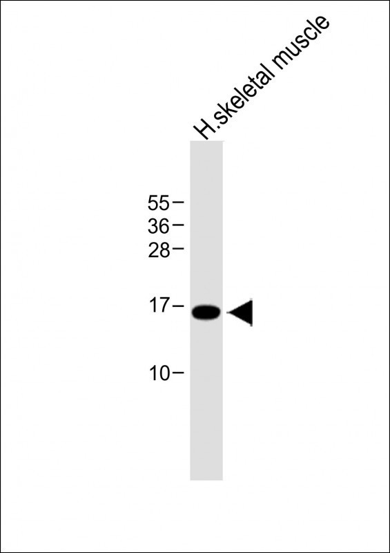 EMP1 Polyclonal Antibody (PA5-72001)