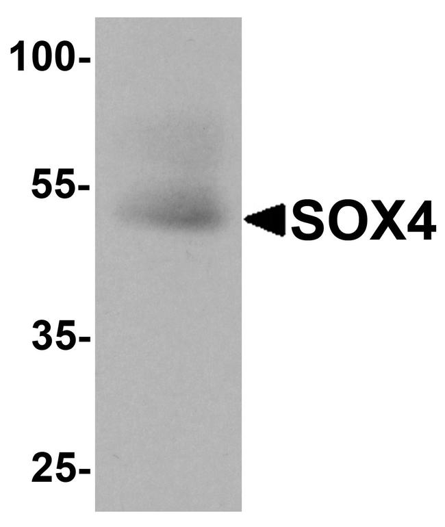 SOX4 Antibody (PA5-72852)