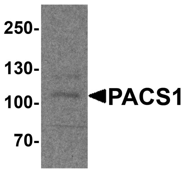 PACS1 Antibody (PA5-72865)