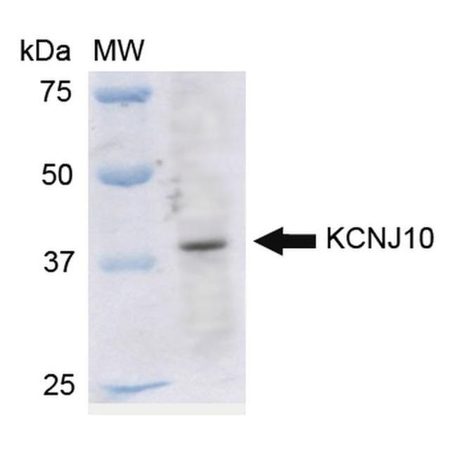 Kir4.1 (KCNJ10) Antibody (PA5-77822)