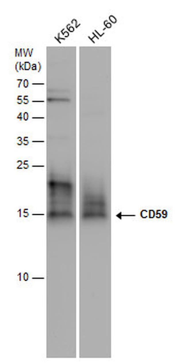 CD59 Antibody (PA5-77898)