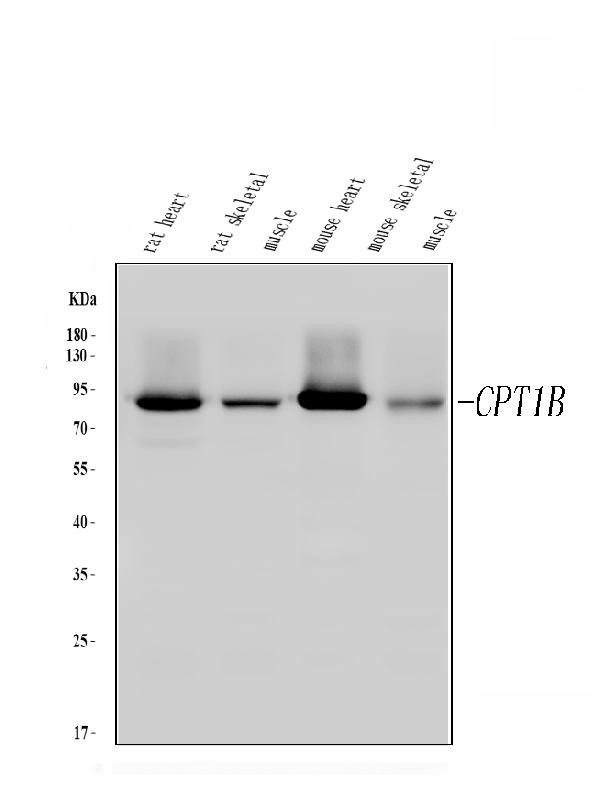 CPT1B Polyclonal Antibody (PA5-79065)