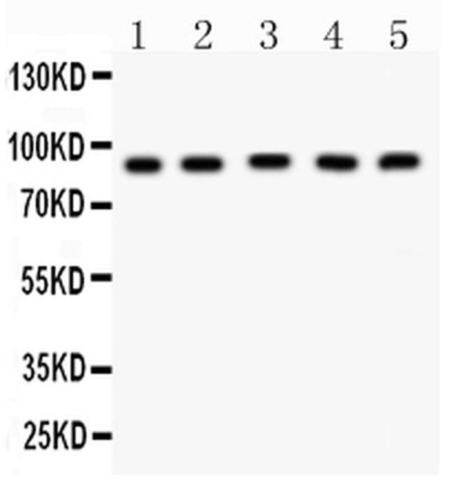 CPT1B Antibody (PA5-79065)
