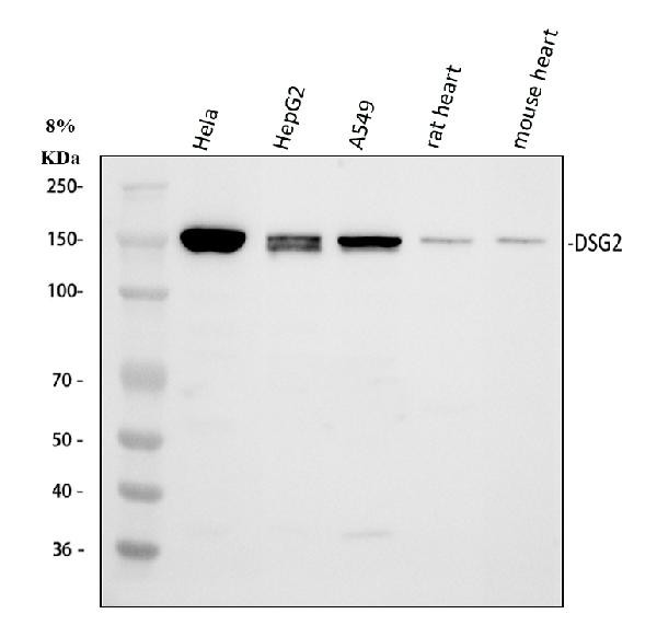 Desmoglein 2 (DSG2) Polyclonal Antibody (PA5-79171)