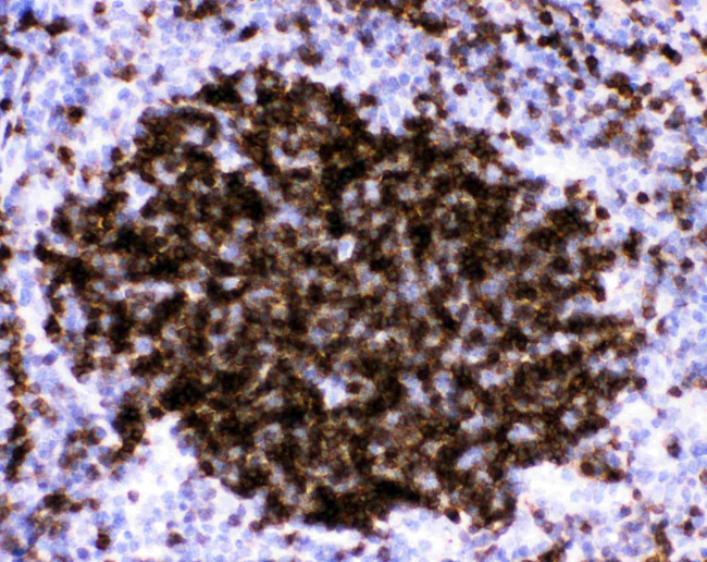 CD23 Antibody (PA5-79242)