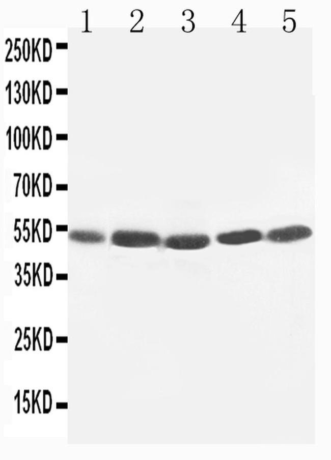 KIM-1 Polyclonal Antibody (PA5-79345)