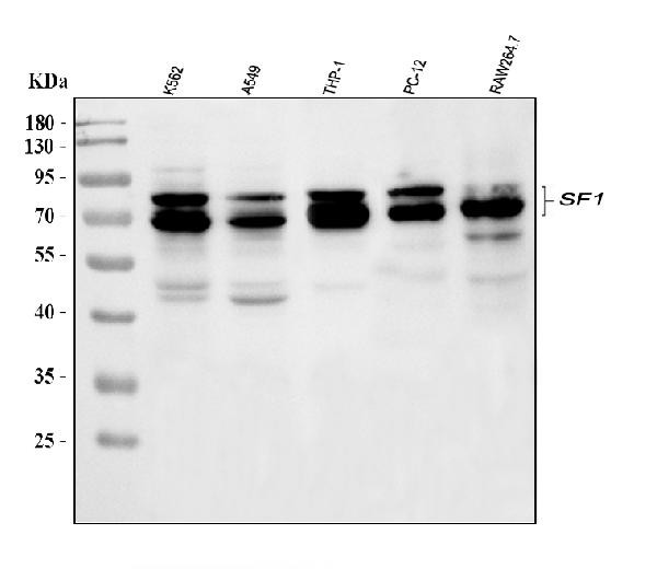 SF1 Polyclonal Antibody (PA5-79984)