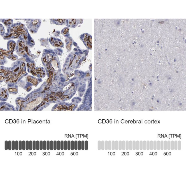 CD36 Polyclonal Antibody (PA5-81996)
