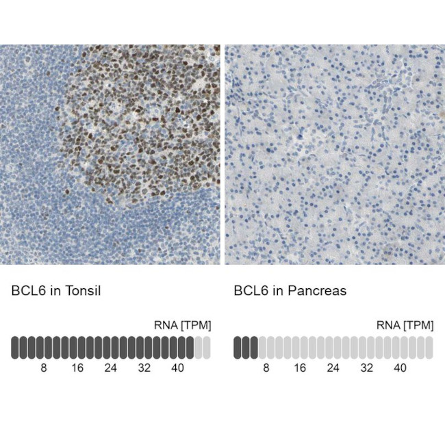 BCL6 Polyclonal Antibody (PA5-82180)