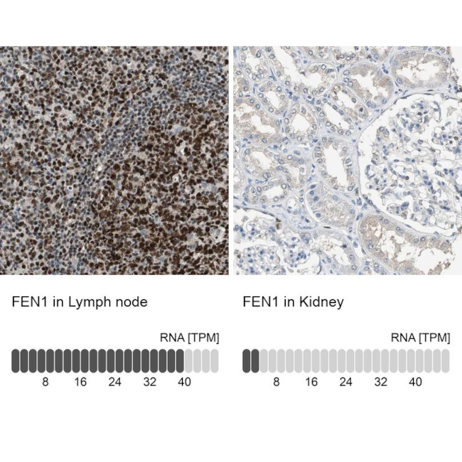 FEN1 Polyclonal Antibody (PA5-82261)