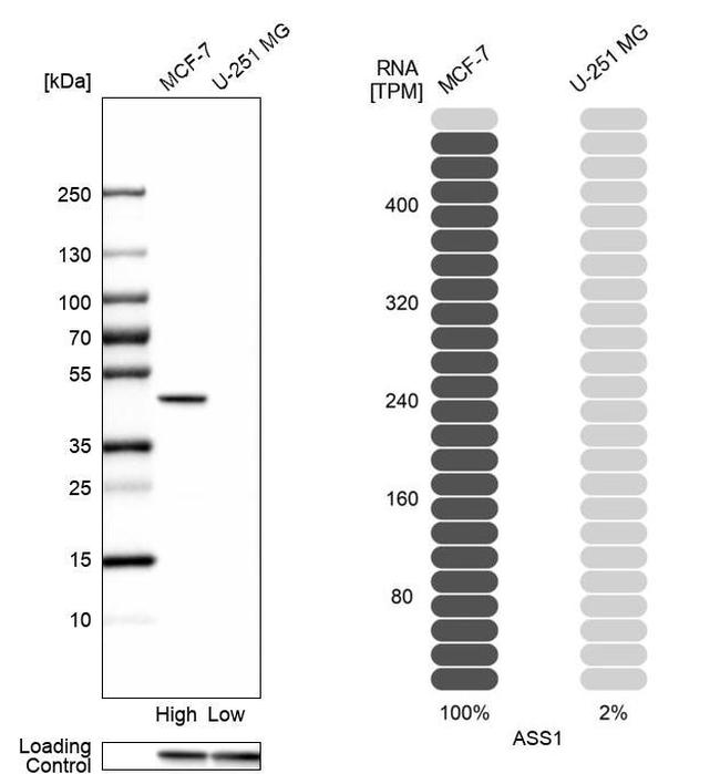 ASS1 Antibody (PA5-82740)