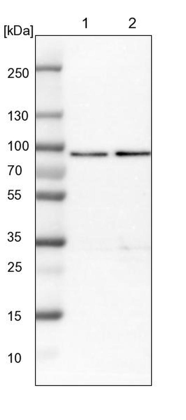 HSD17B4 Antibody (PA5-82758)