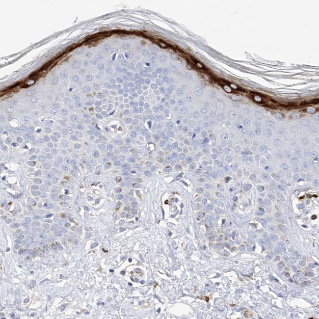 Filaggrin Antibody (PA5-83128)