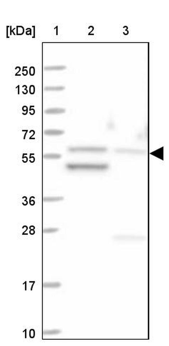 MCCC2 Antibody (PA5-83410)