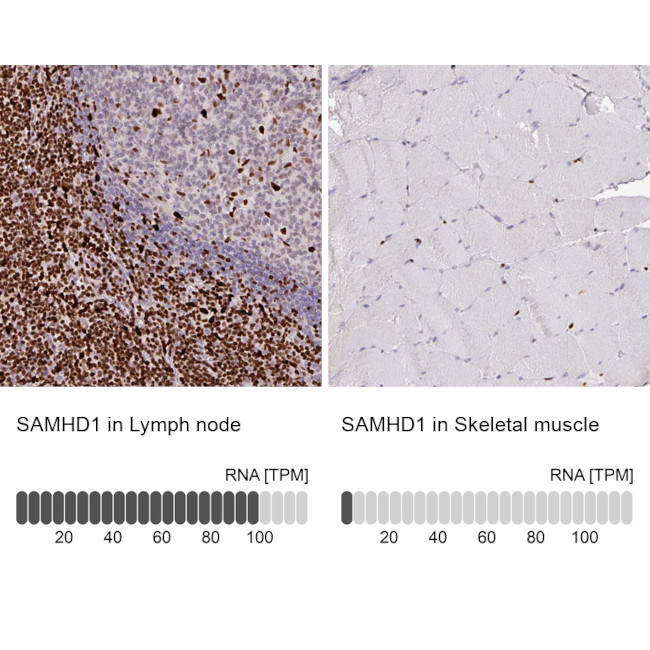 SAMHD1 Antibody (PA5-83852)