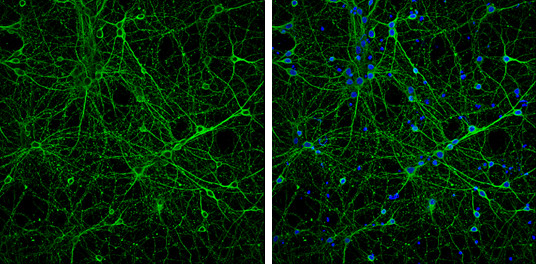 beta-3 Tubulin Antibody (PA5-85639)