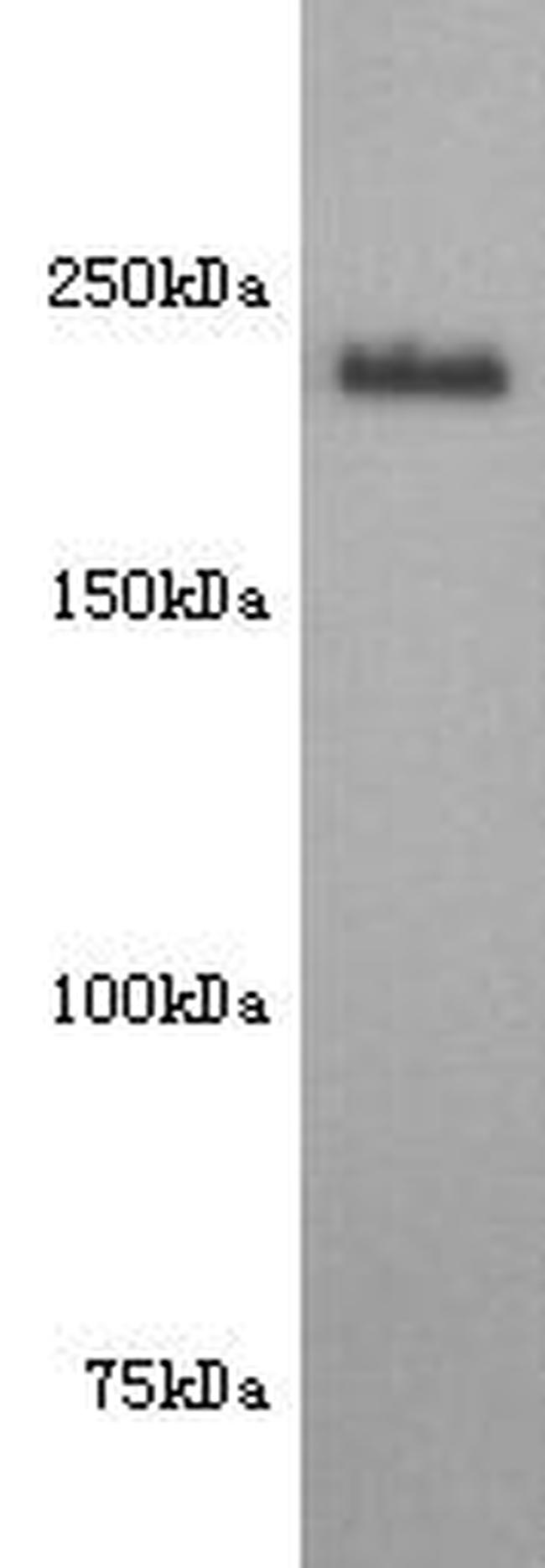 CD171 (L1CAM) Antibody (PA5-85876)