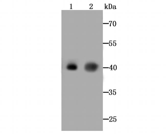 ASS1 Polyclonal Antibody (PA5-86054)